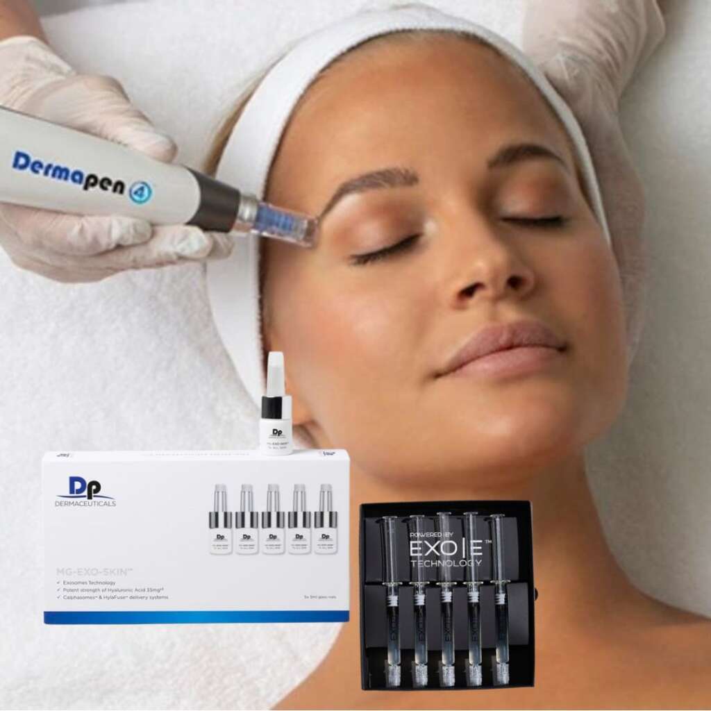 Microneedling with EXOSOMES or PDRN - One session - Coquitlam Medical ...